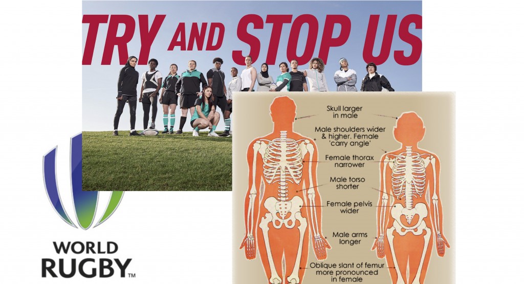 Transgender Anatomy Diagram